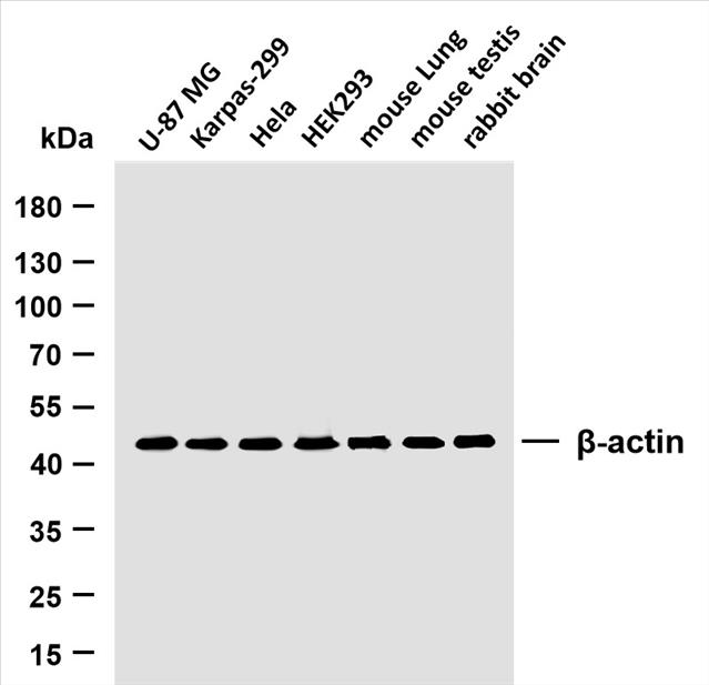 Cyclin D1 (Phospho-Ser90) Antibody (A9415) | Assay Biotech Inc.